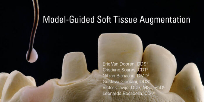 Analog Protocol for Obtaining the ideal soft tissue support and contour ...